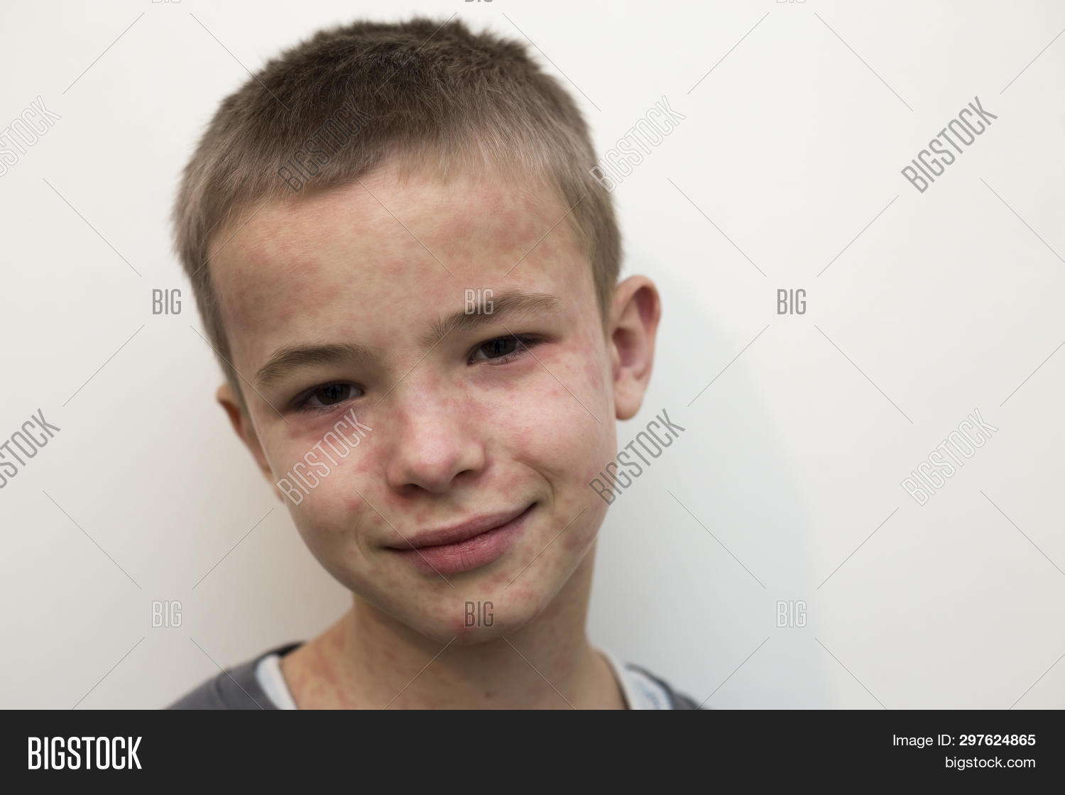 Portrait Sick Smiling Image & Photo (Free Trial) | Bigstock