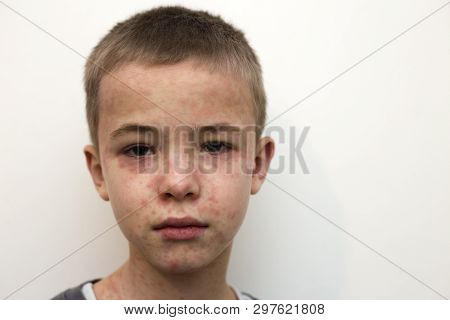 Portrait Sick Sad Boy Image & Photo (Free Trial) | Bigstock