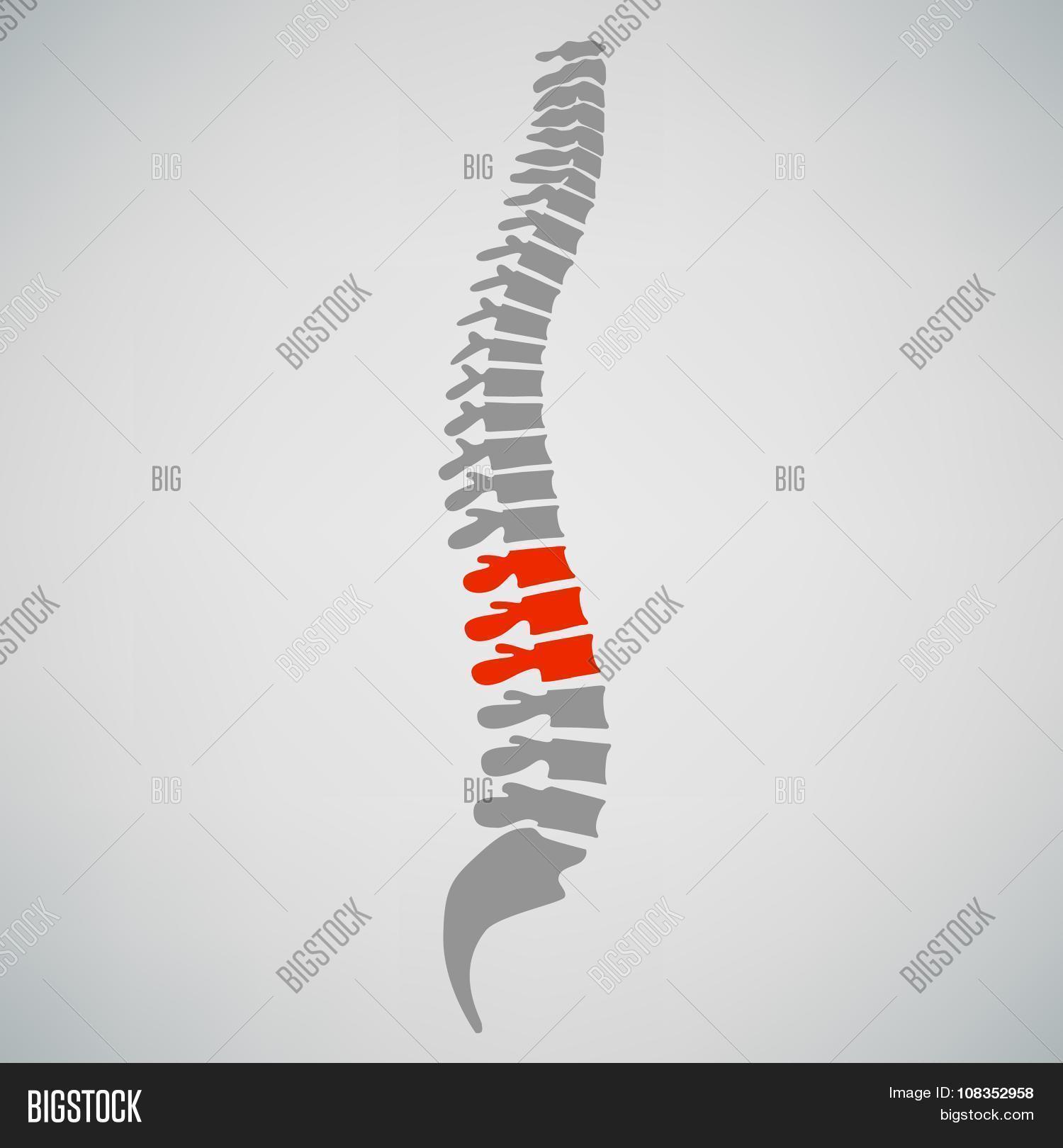 Spine Diagnostics Vector & Photo (Free Trial) | Bigstock
