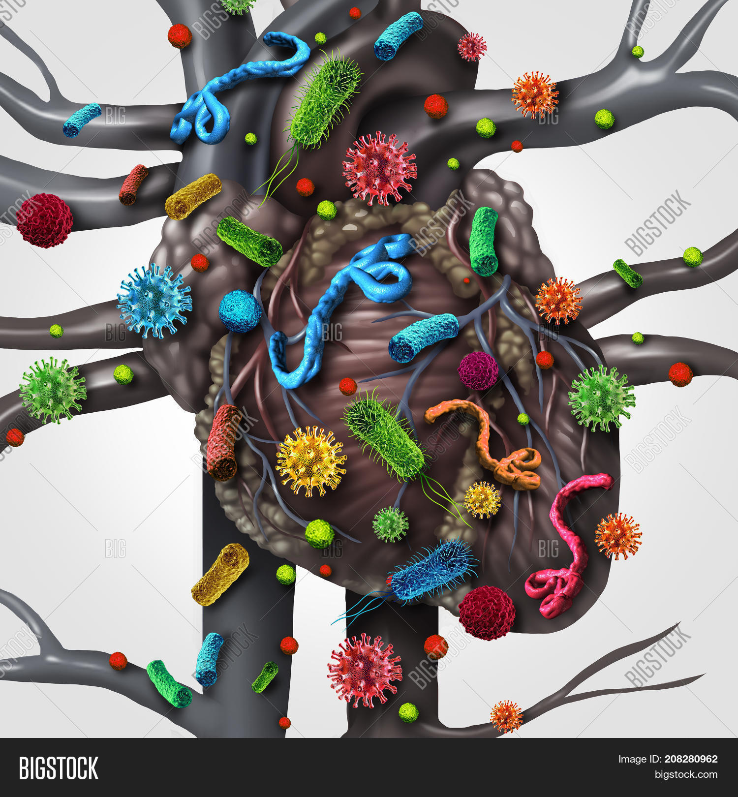 Heart Infection Image & Photo (Free Trial) | Bigstock