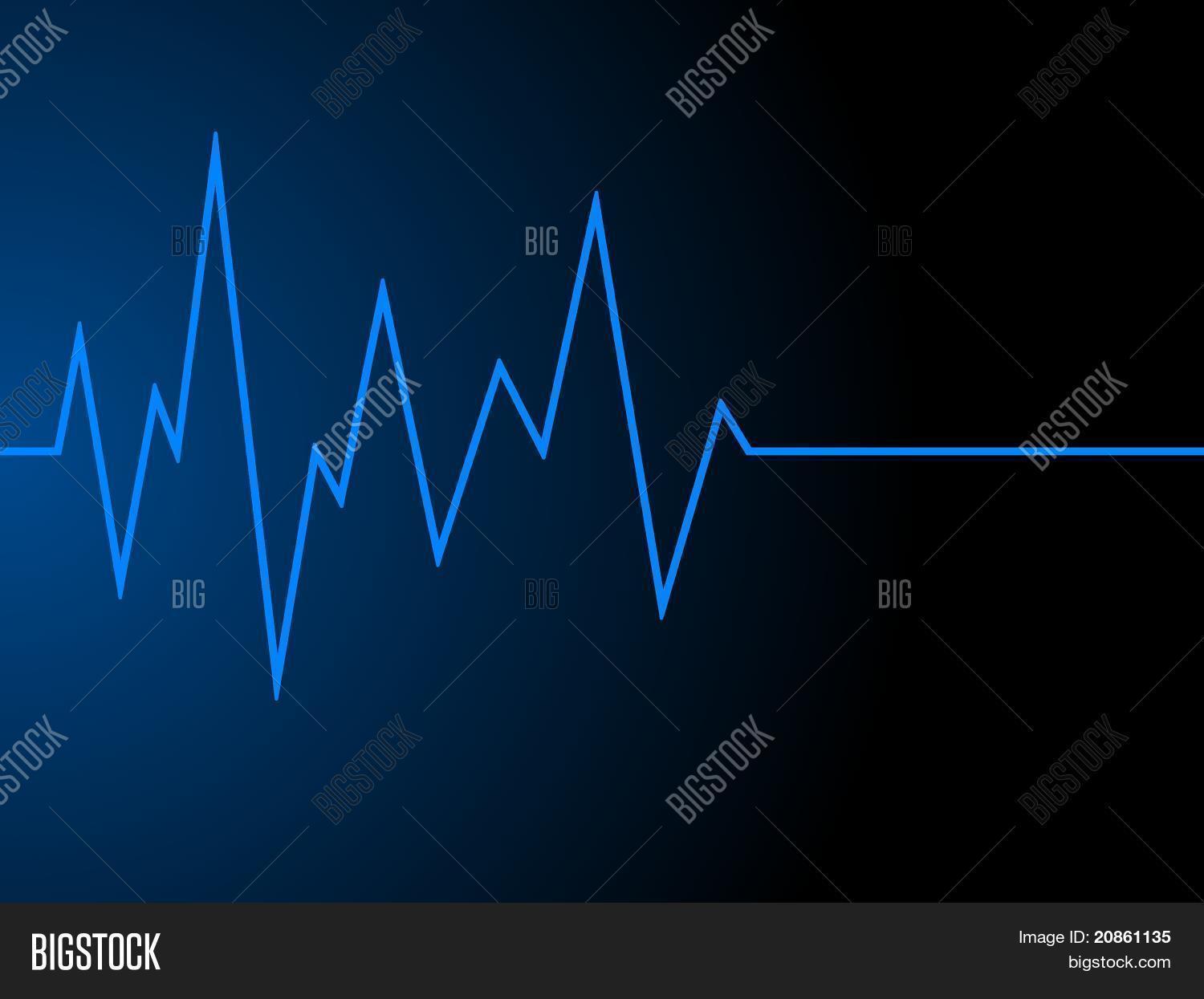Radio Wave Image & Photo (Free Trial) | Bigstock
