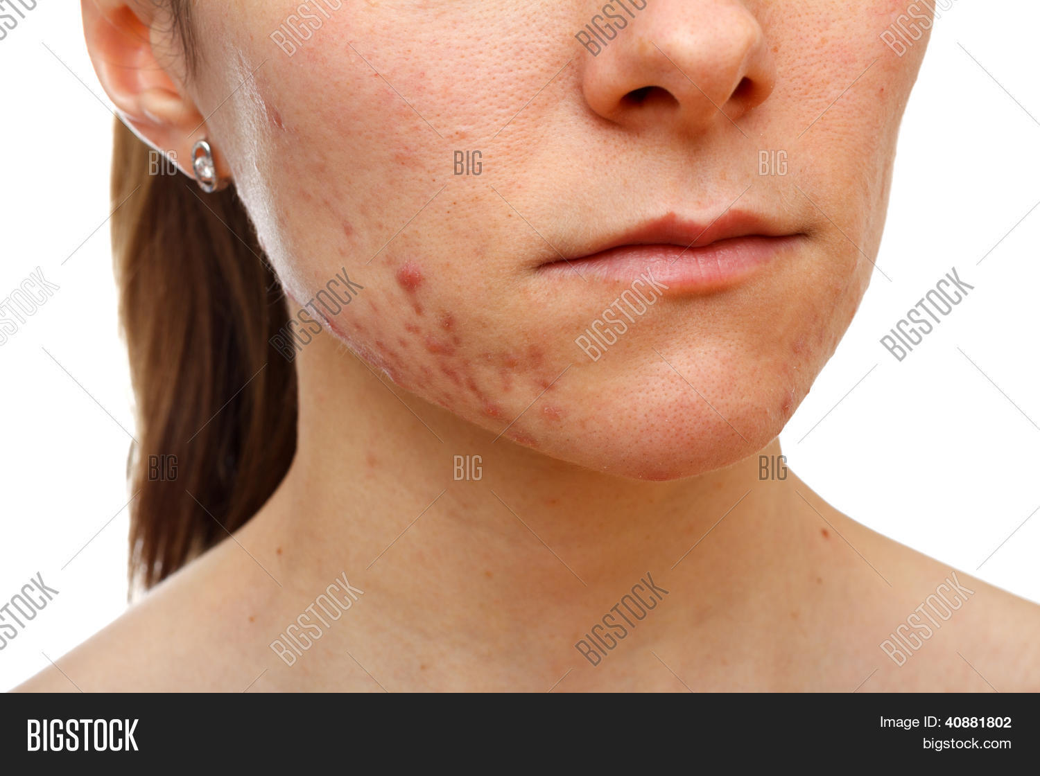 Young Girl Skin Image & Photo (Free Trial) | Bigstock