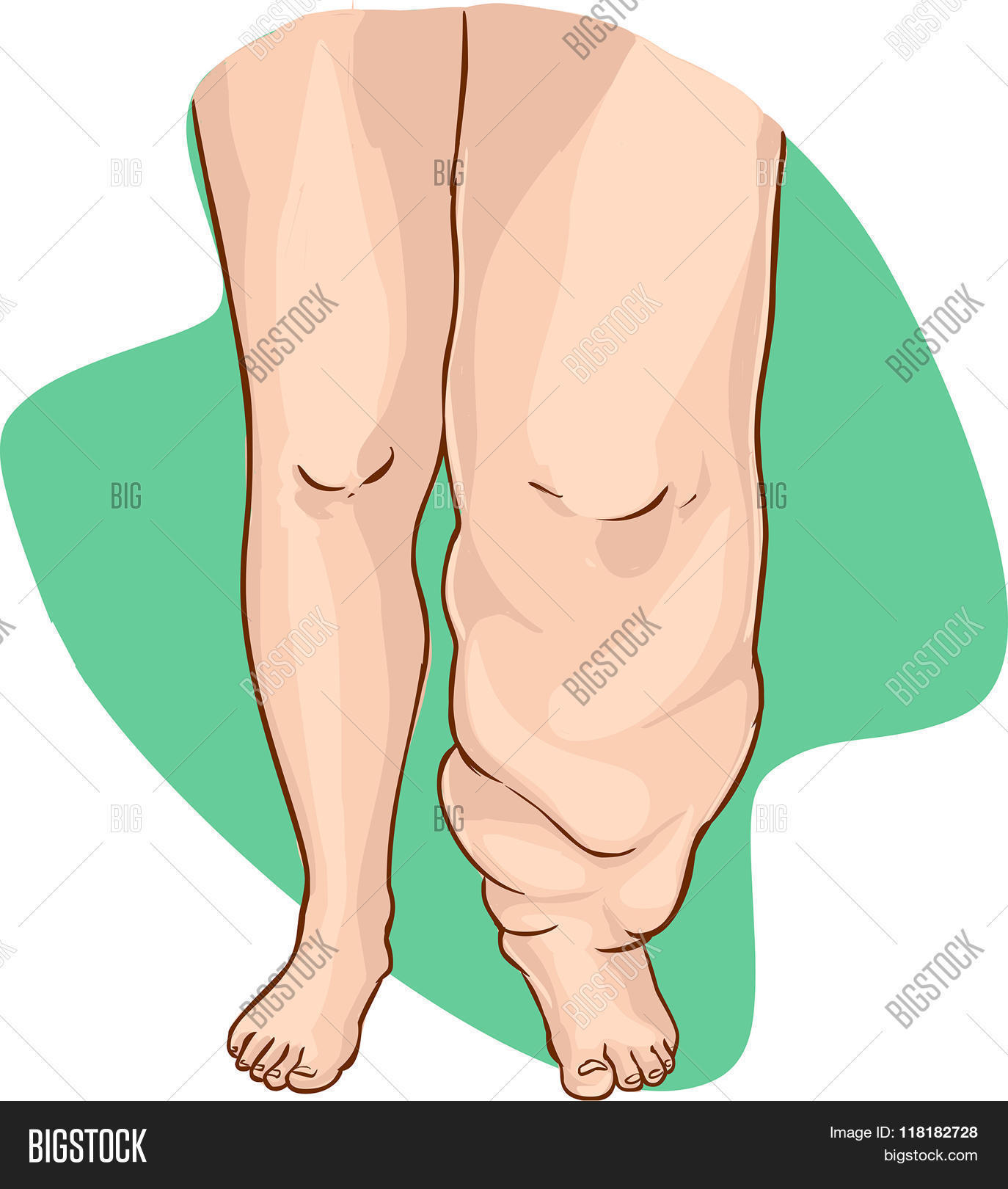 Vector Illustration Vector & Photo (Free Trial) | Bigstock