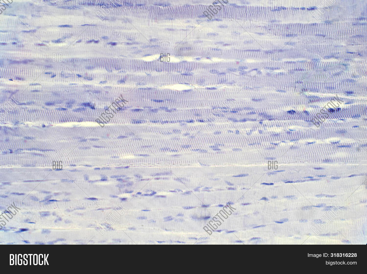 Human Skeletal Muscle Image & Photo (Free Trial) | Bigstock