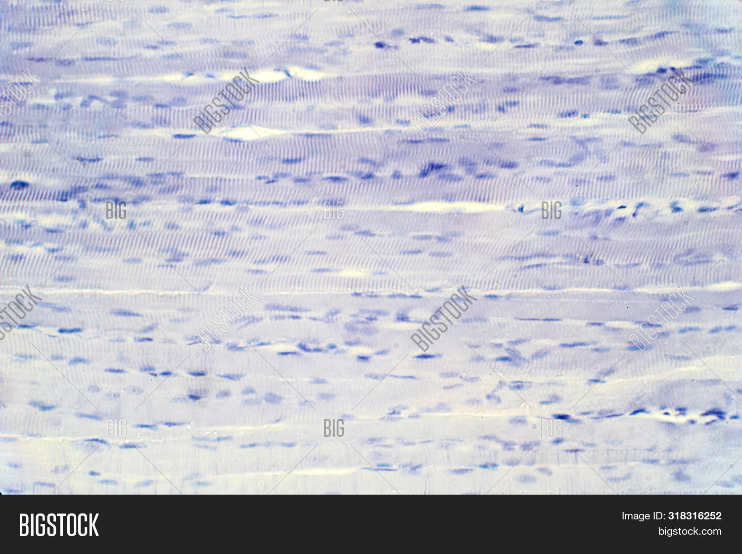 Human Skeletal Muscle Image & Photo (Free Trial) | Bigstock
