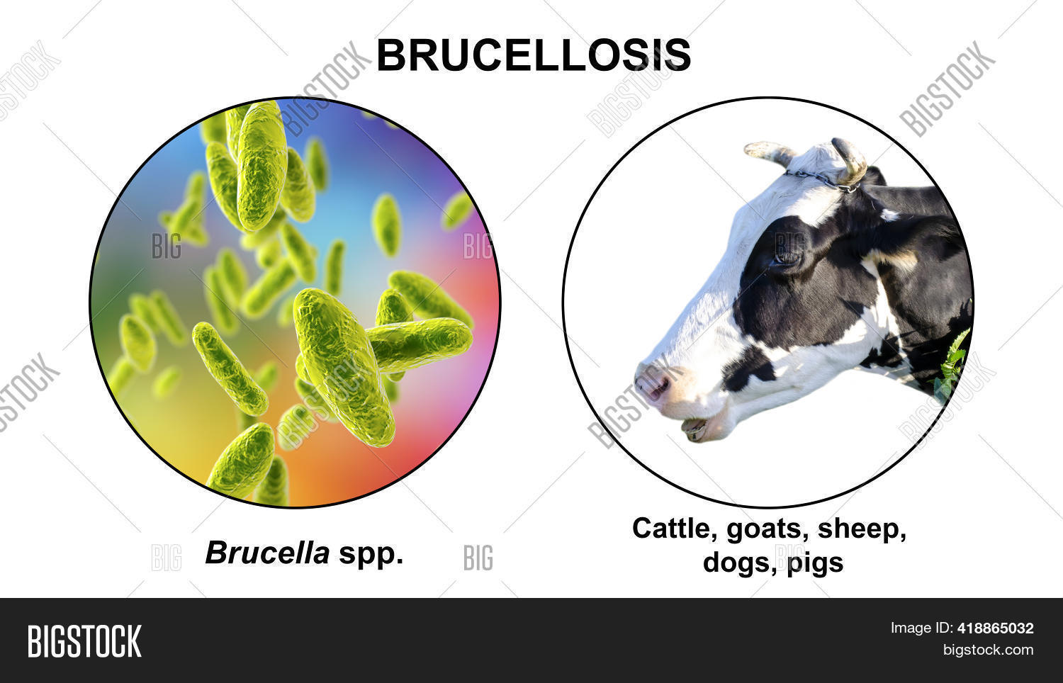 Imagen y foto Brucellosis. 3d (prueba gratis) | Bigstock