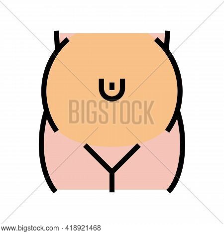Umbilical Hernia Vector & Photo (Free Trial) | Bigstock