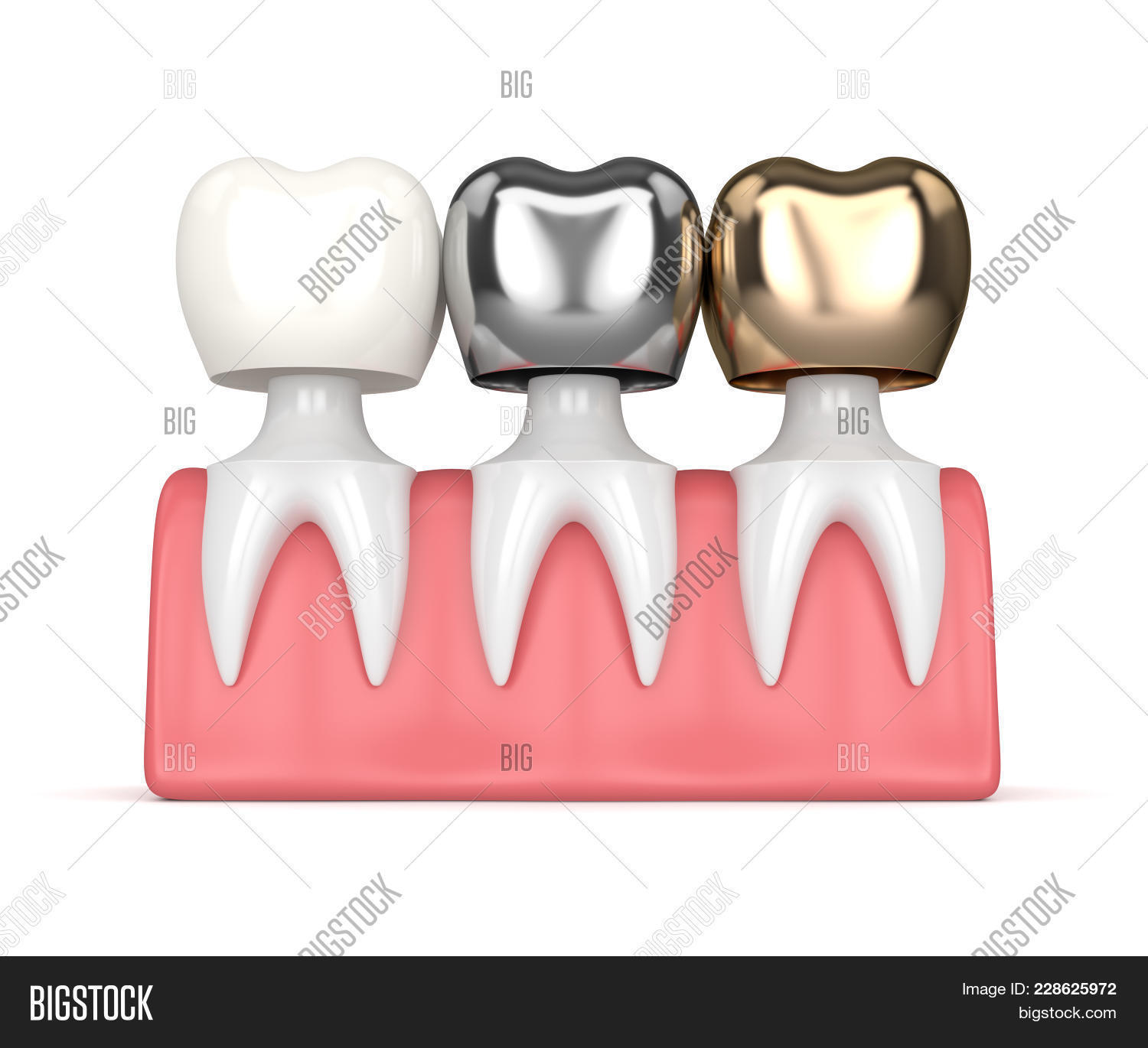 3D Render Teeth Image & Photo (Free Trial) | Bigstock