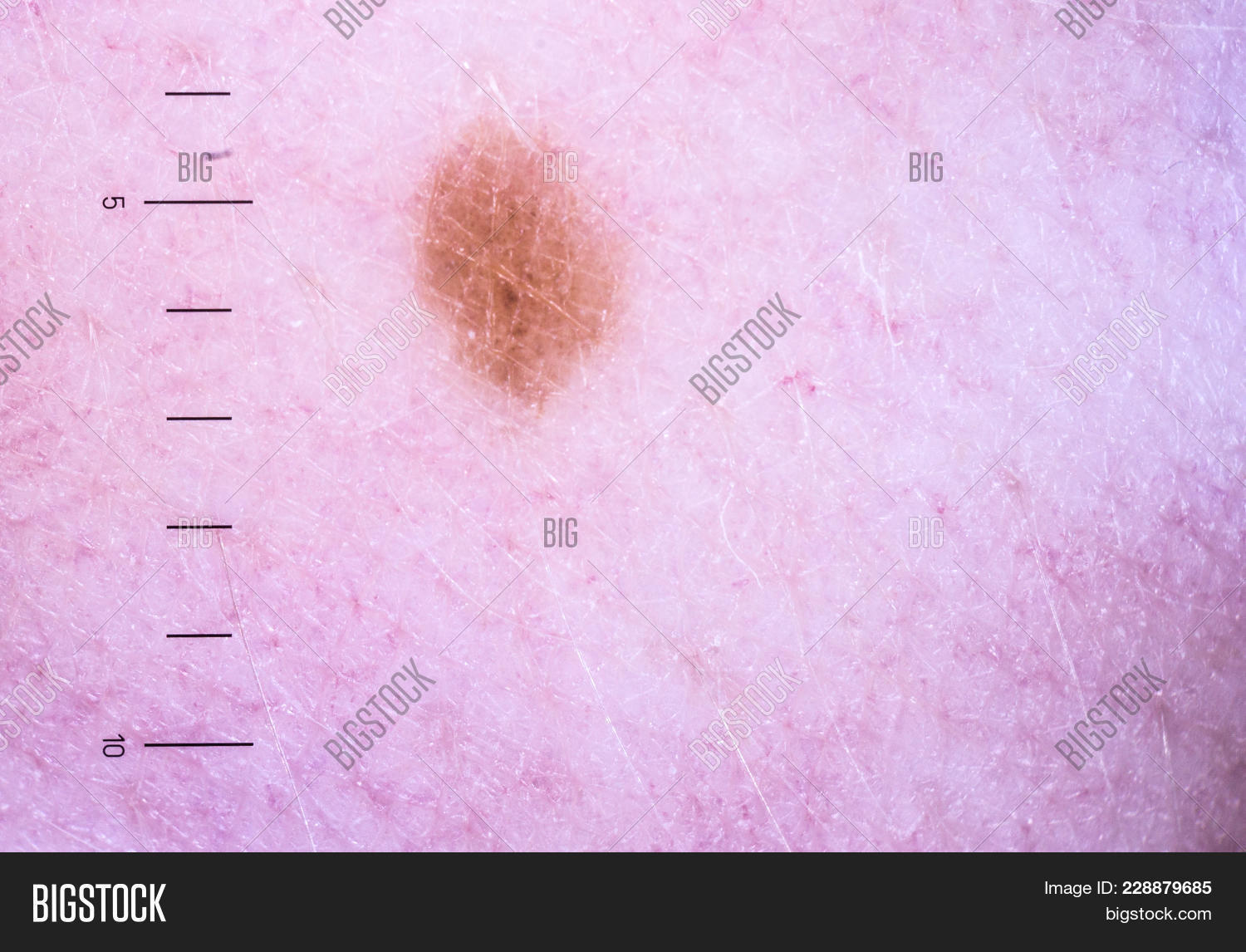 Enlarged Image Skin Image & Photo (Free Trial) | Bigstock