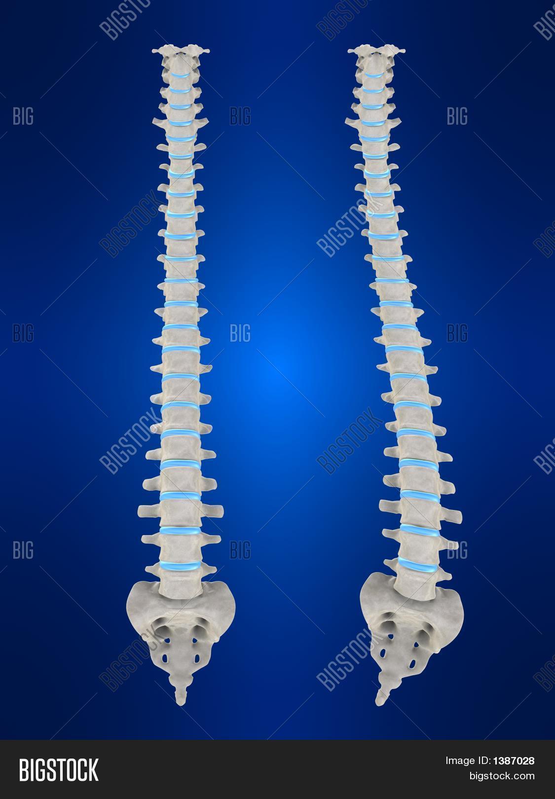 Scoliose Image & Photo (Free Trial) | Bigstock