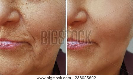 Face Old Wrinkle Woman Image & Photo (Free Trial) | Bigstock