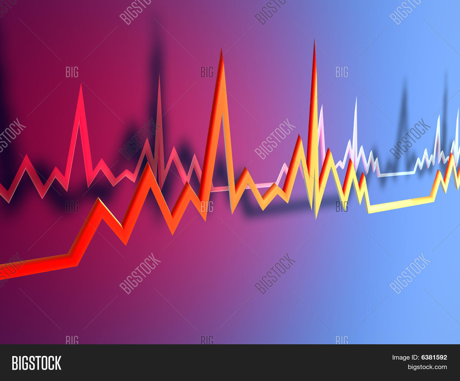 EKG Lines Image & Photo (Free Trial) | Bigstock