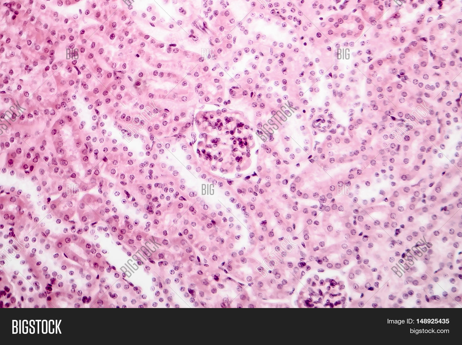 Light Micrograph Image & Photo (Free Trial) | Bigstock