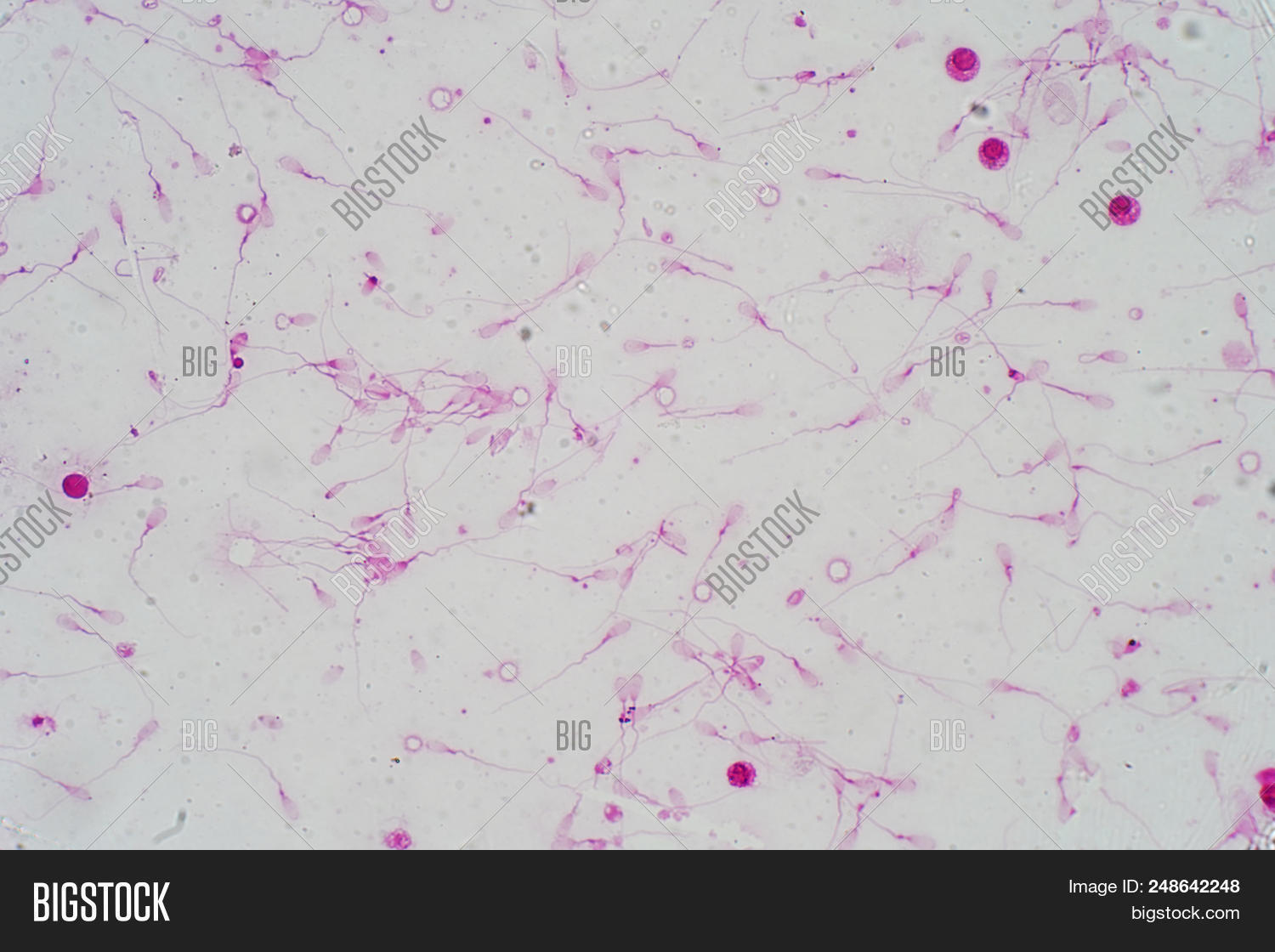 Human Sperm Morphology Image & Photo (Free Trial) | Bigstock