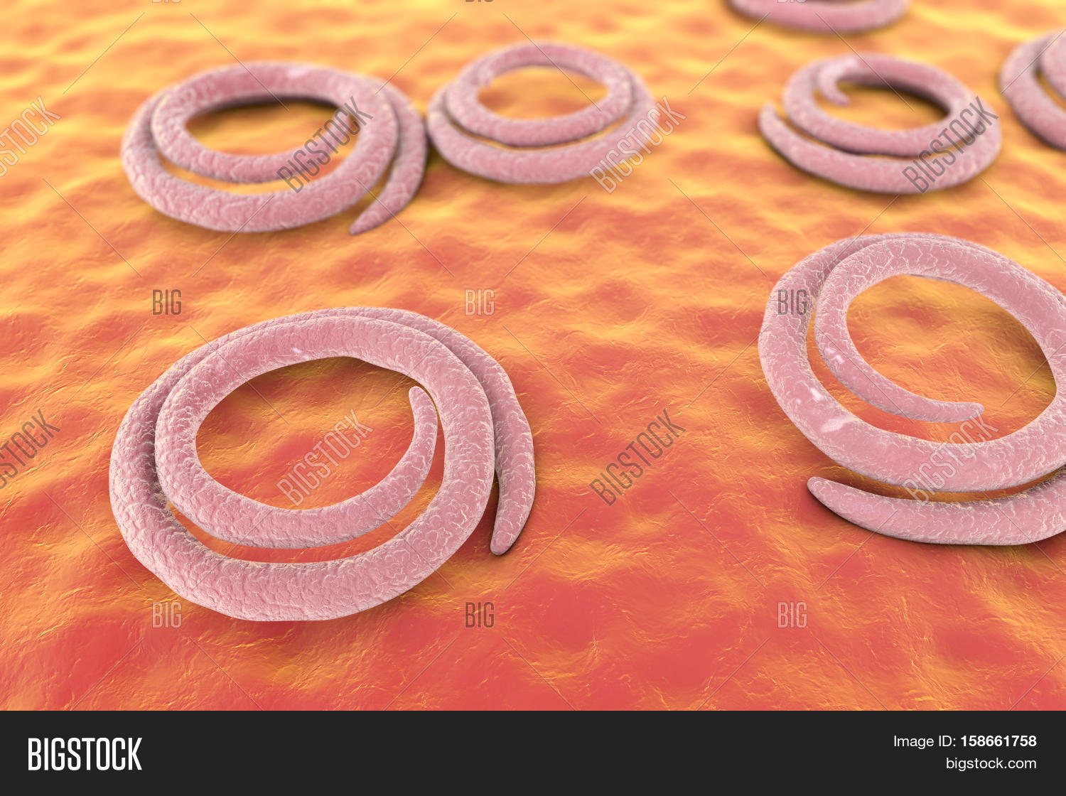 Roundworms Trichina Image & Photo (Free Trial) | Bigstock