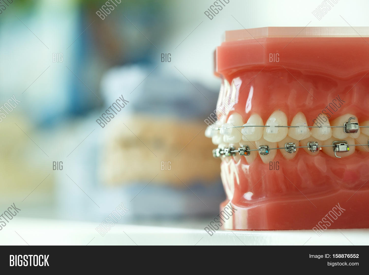 Model Human Jaw Wire Image & Photo (Free Trial) | Bigstock