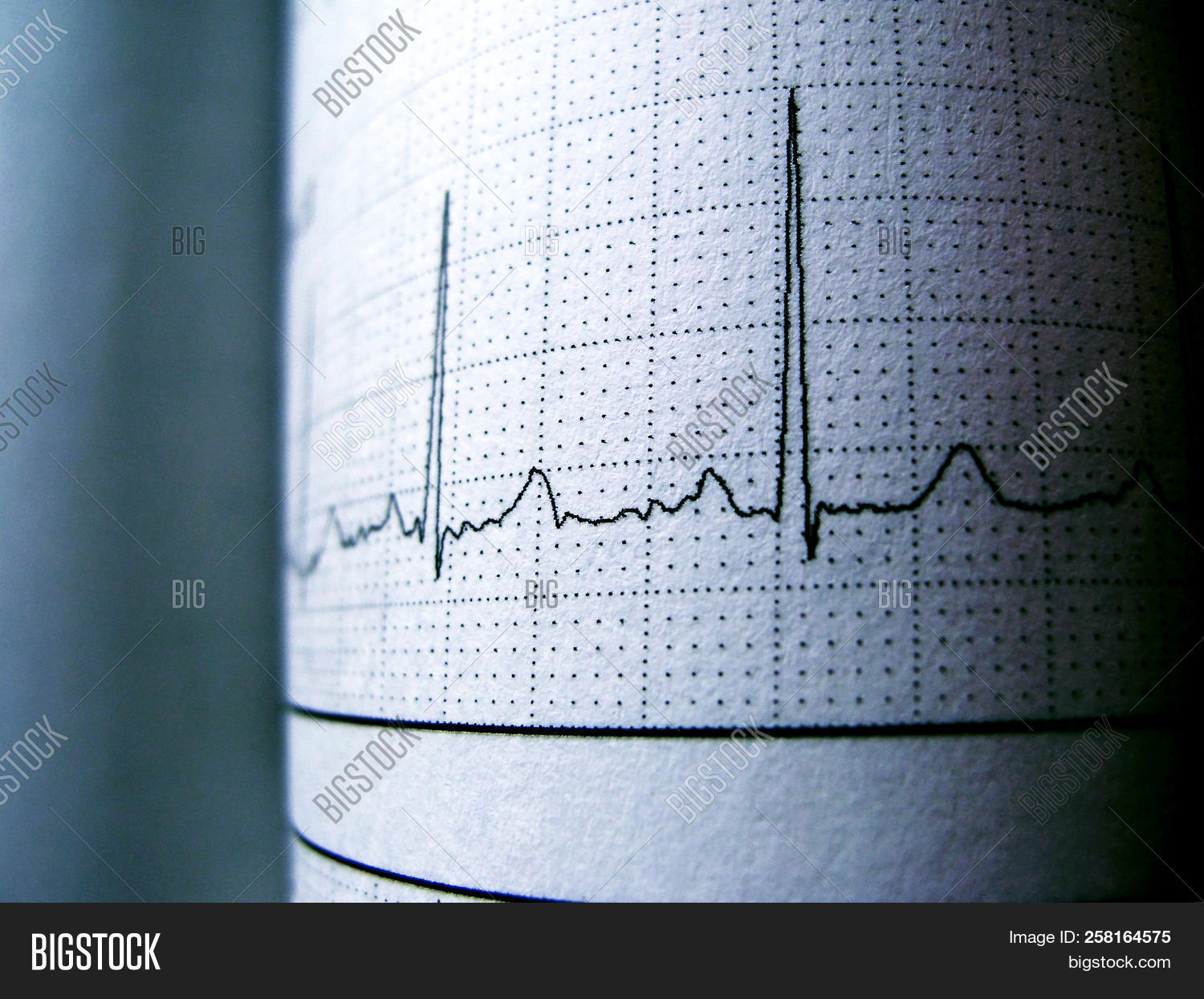 Sinus Heart Rhythm On Image & Photo (Free Trial) | Bigstock