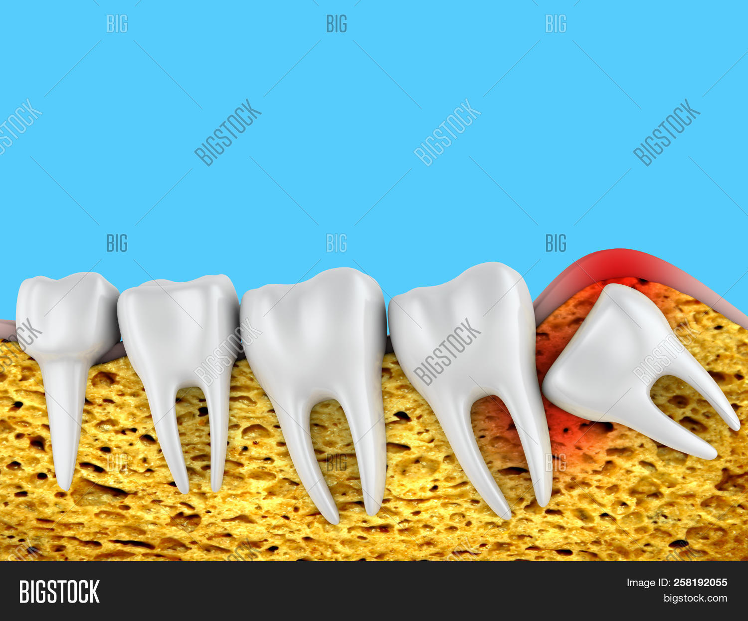 Dental Row Molars Image & Photo (Free Trial) | Bigstock