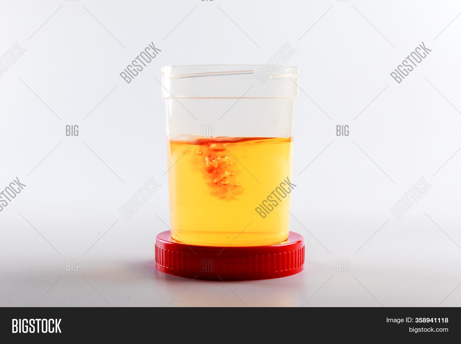 Blood Urine Analysis Image & Photo (Free Trial) | Bigstock