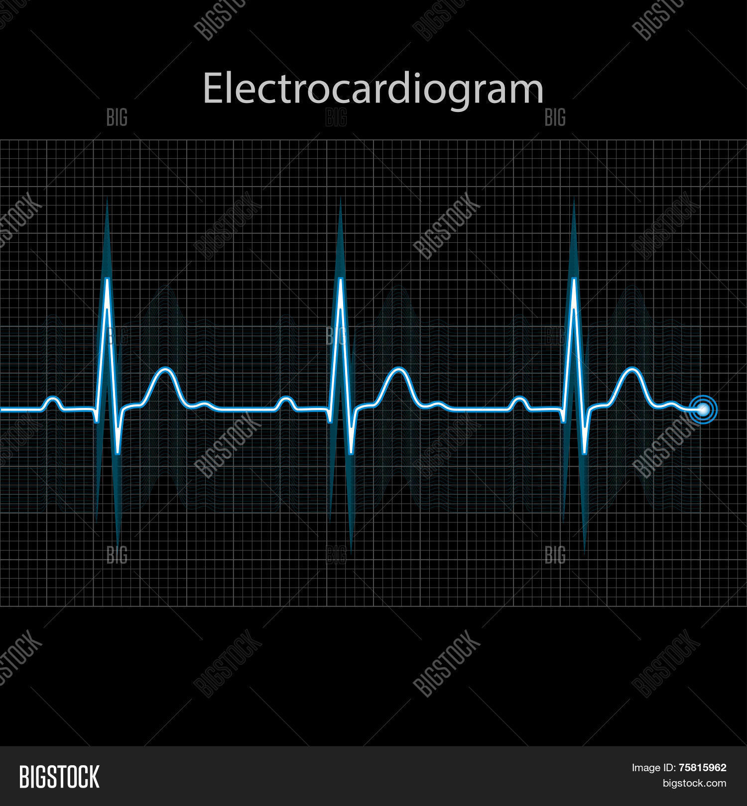 Electrocardiogram 2D Vector & Photo (Free Trial) | Bigstock