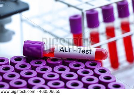 Alt Test Look Image & Photo (Free Trial) | Bigstock