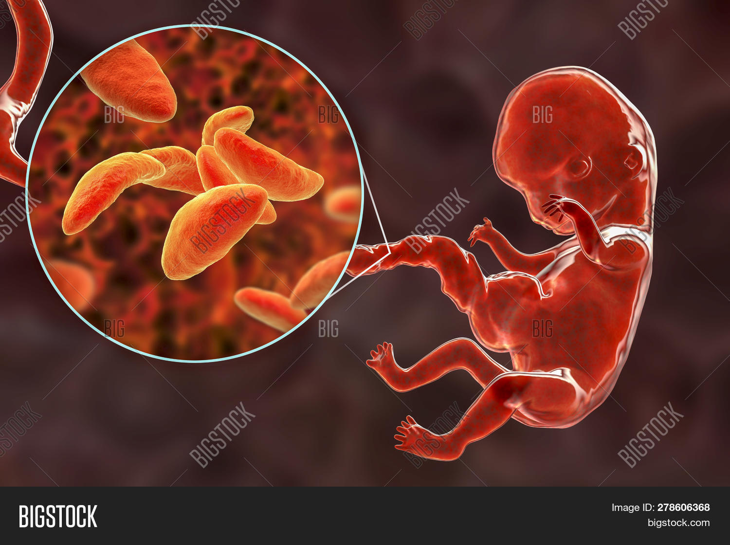 Transplacental Image & Photo (Free Trial) | Bigstock