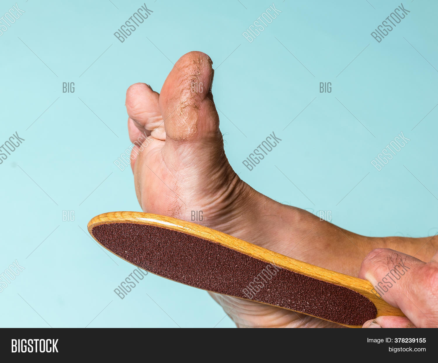 Man Scrapes Rough Skin Image & Photo (Free Trial) | Bigstock
