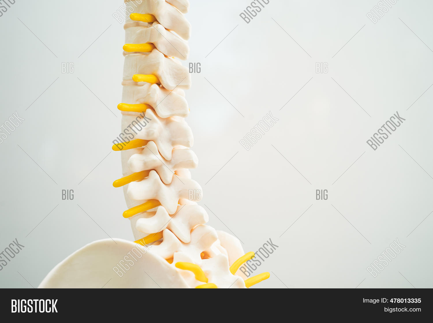 Lumbar Spine Displaced Image & Photo (Free Trial) | Bigstock
