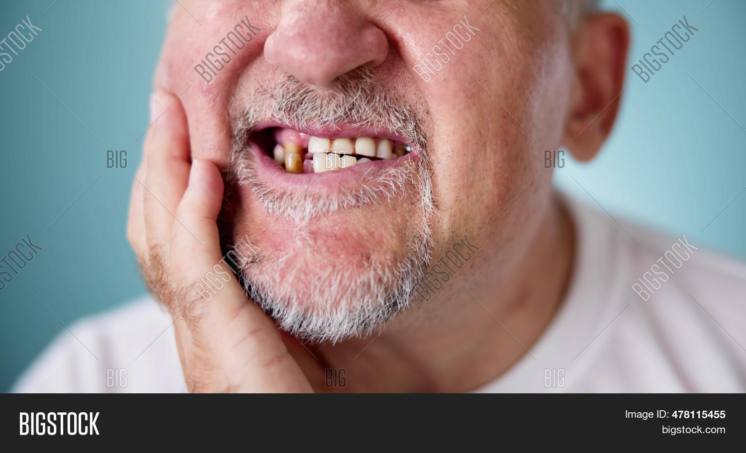 Sore Tooth Decay. Man Image & Photo (Free Trial) | Bigstock