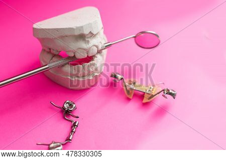 Dental Models Top View Image & Photo (Free Trial) | Bigstock