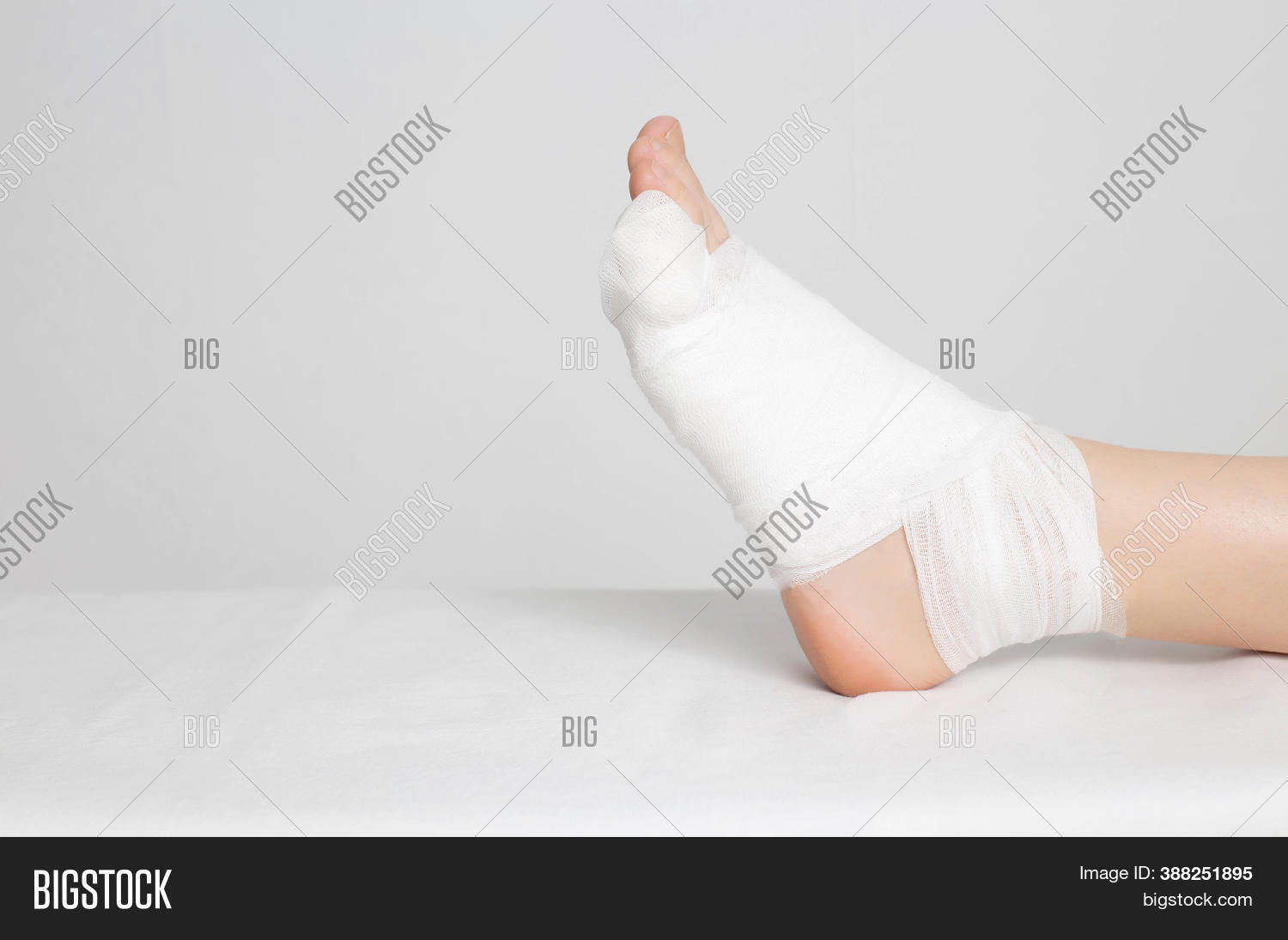 Mans Bandaged Foot Image & Photo (Free Trial) | Bigstock