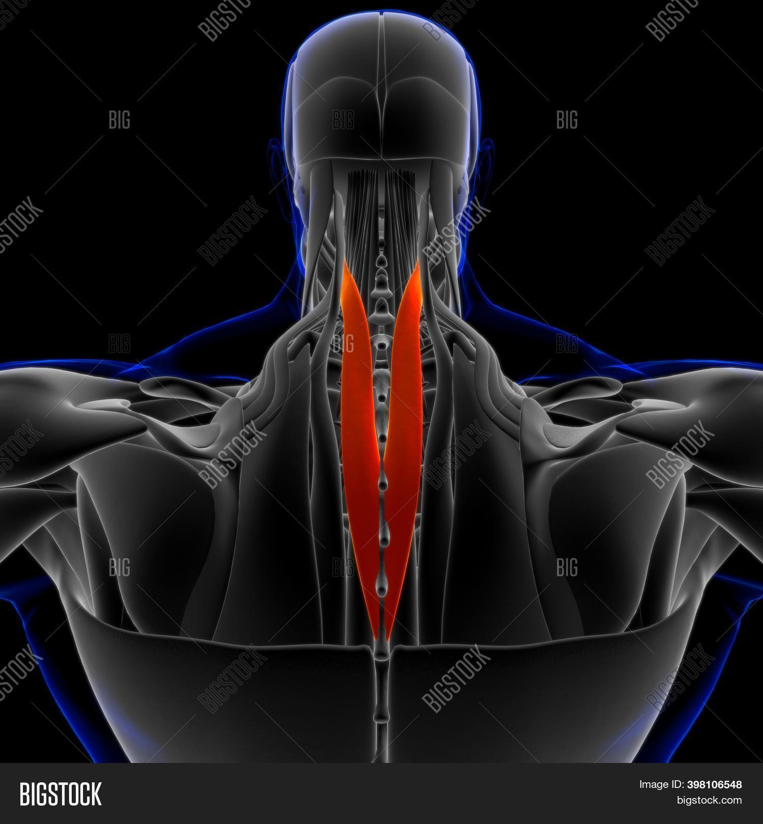 Splenius Cervicis Image & Photo (Free Trial) | Bigstock