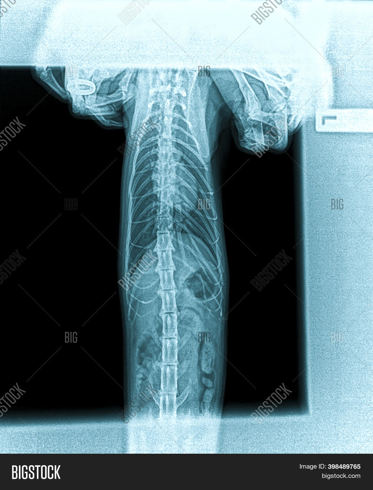 X-ray Cat's Internal Image & Photo (Free Trial) | Bigstock