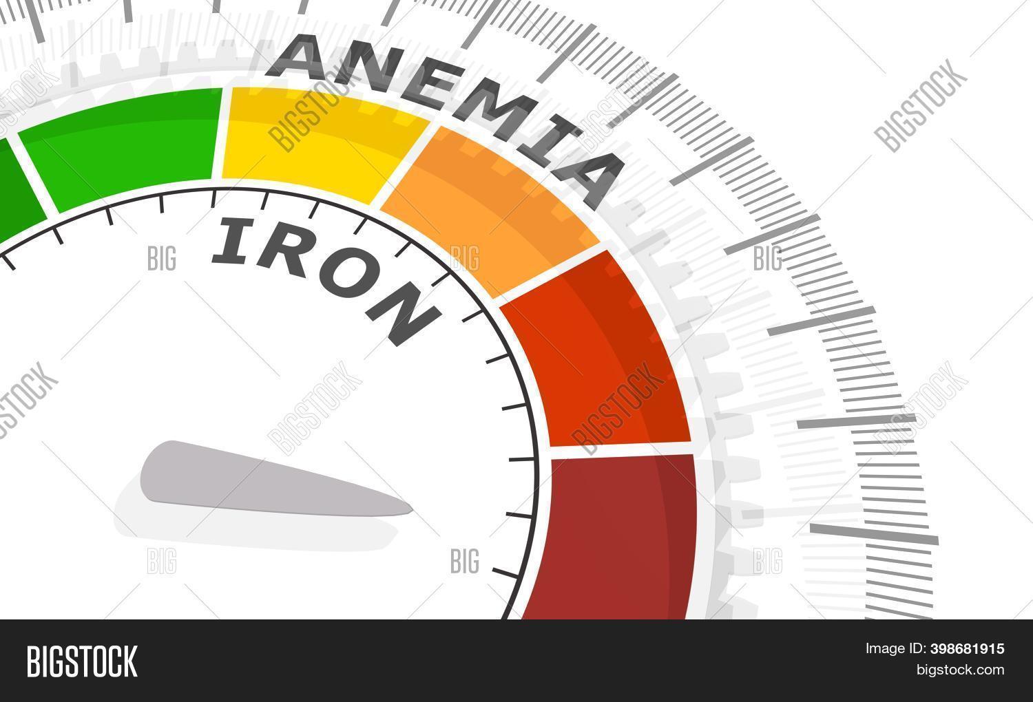 Gradient Scale. Anemia Image & Photo (Free Trial) | Bigstock