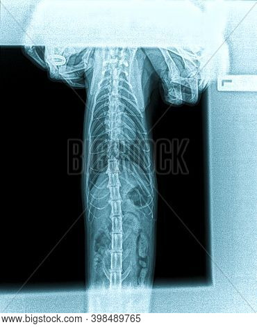 X-ray Cat's Internal Image & Photo (Free Trial) | Bigstock