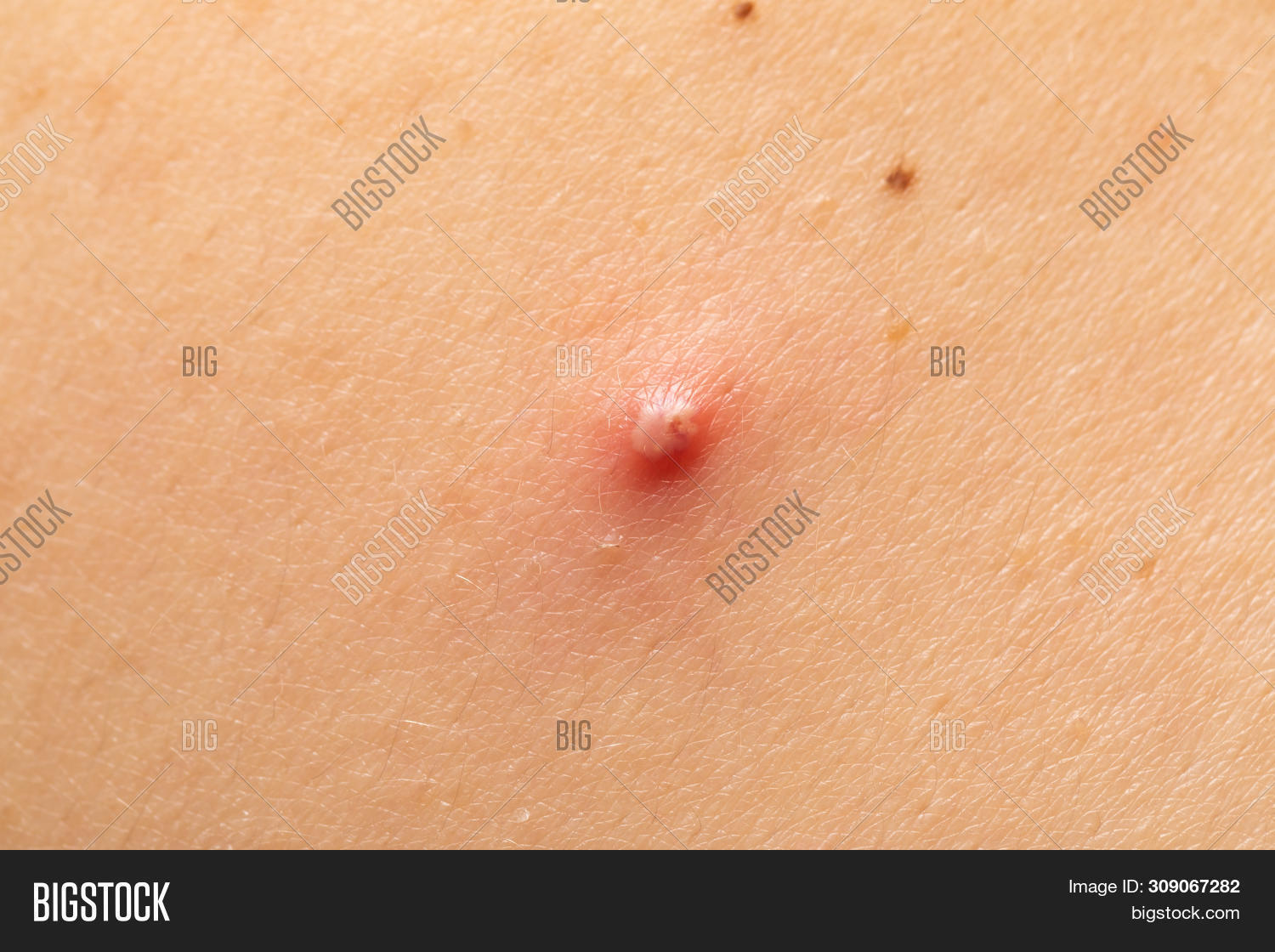 Close Picture Red Image & Photo (Free Trial) | Bigstock