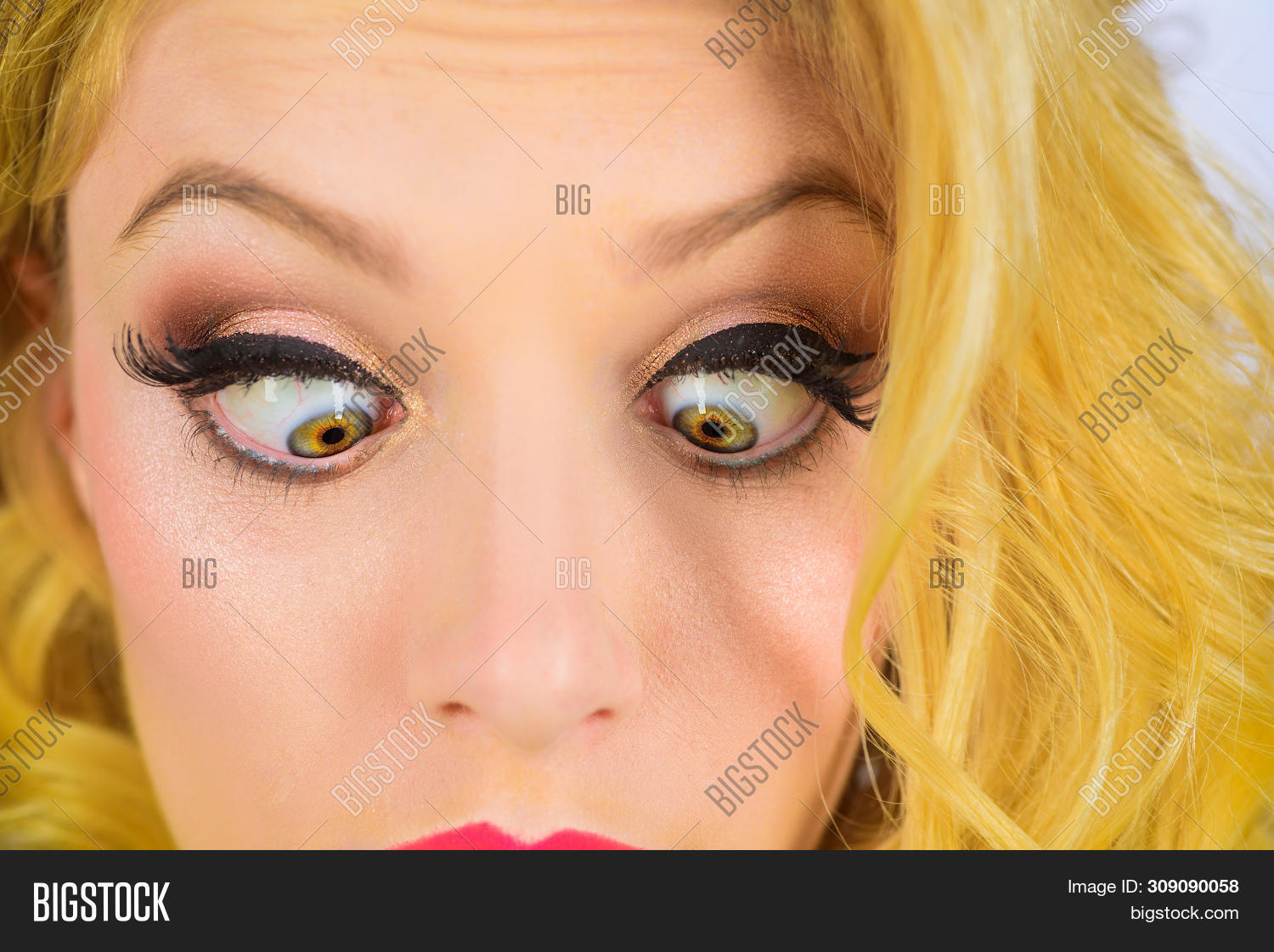 Young Girl Strabismus Image & Photo (Free Trial) | Bigstock