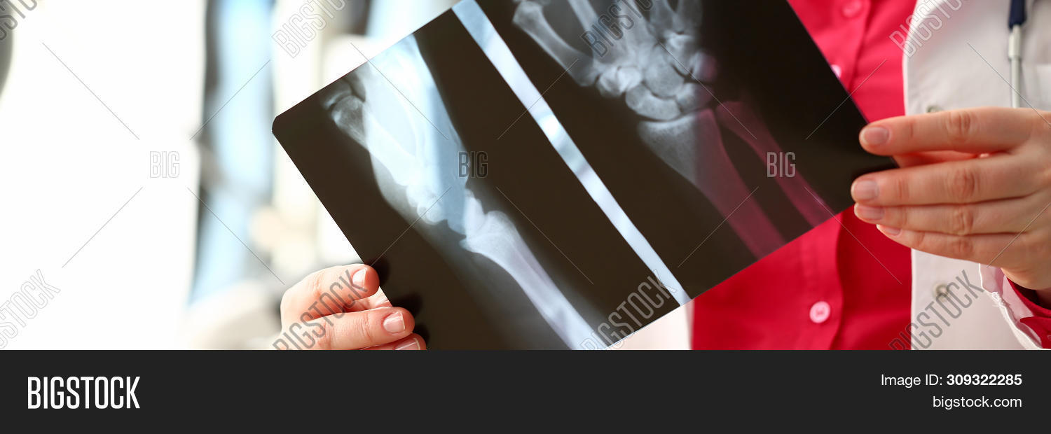 Female Radiologist Image & Photo (Free Trial) | Bigstock