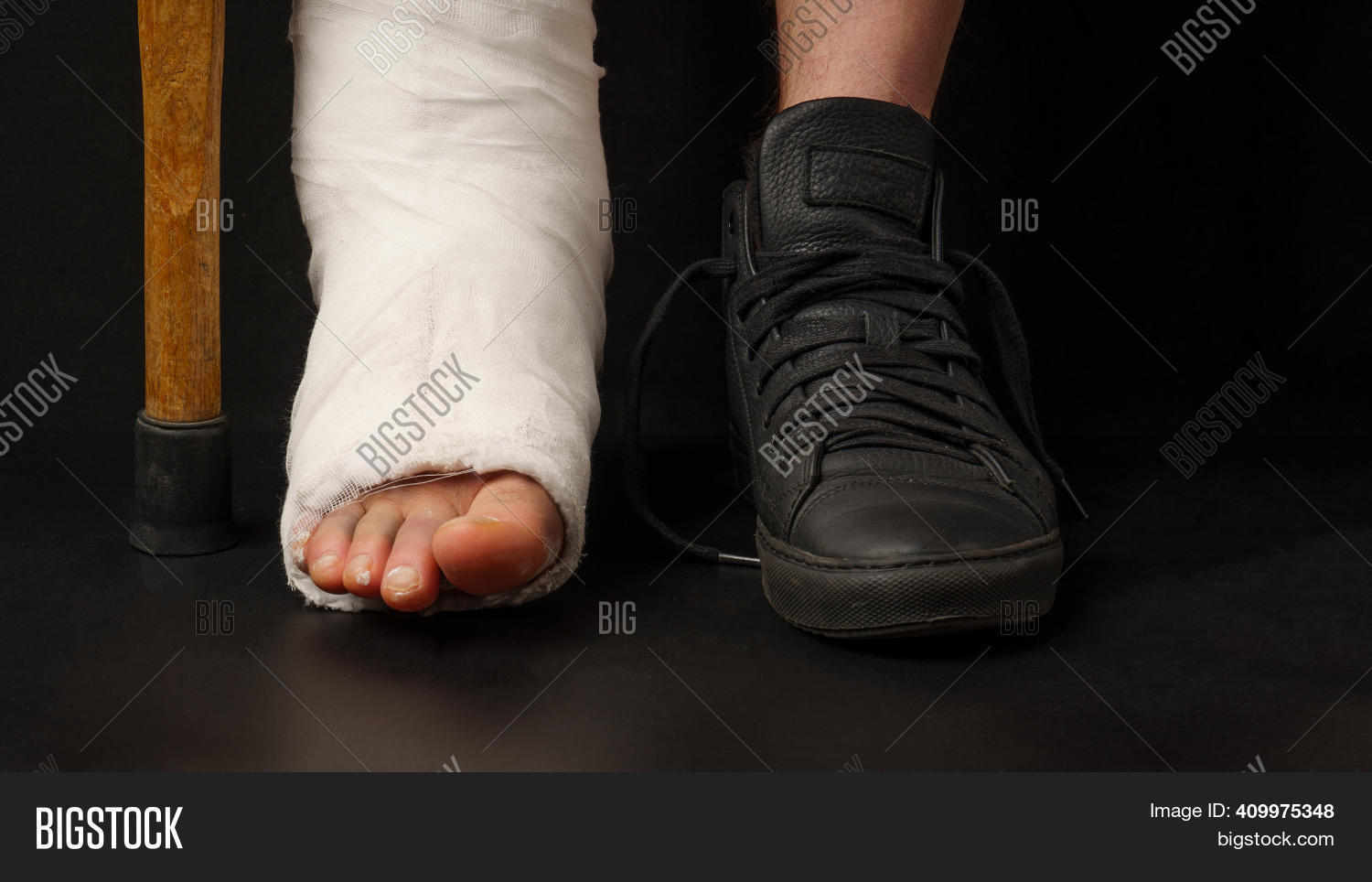 Young Man Broken Ankle Image & Photo (Free Trial) | Bigstock