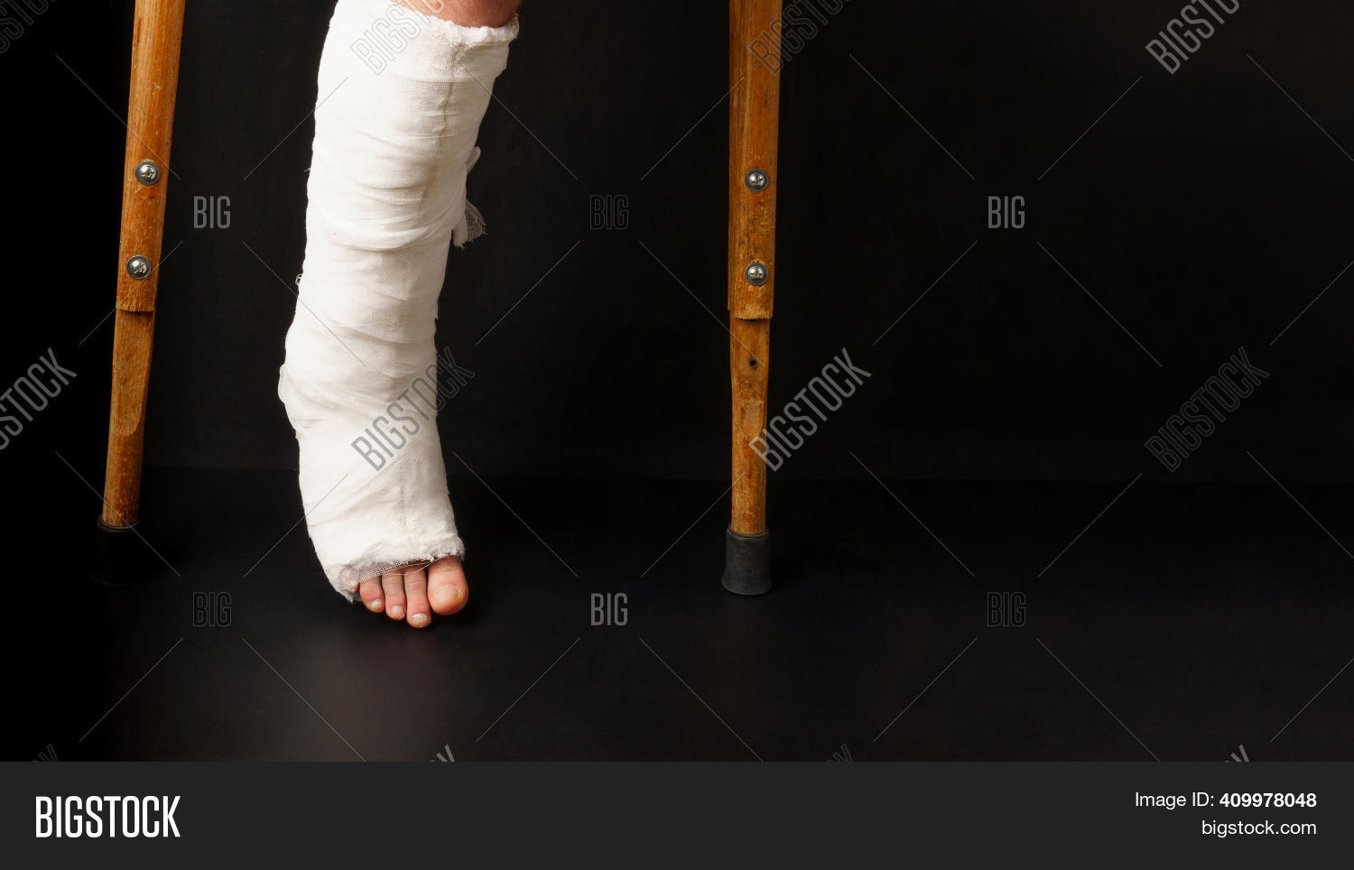 Leg Cast Two Crutches Image & Photo (Free Trial) | Bigstock