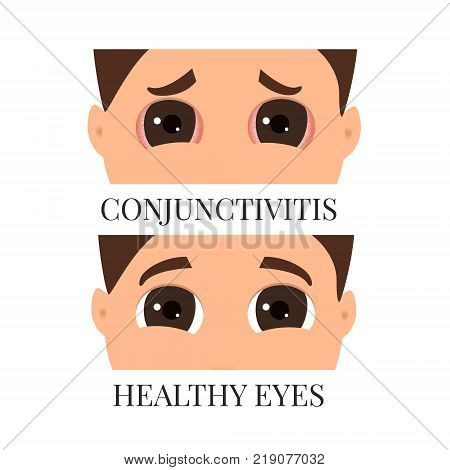 Man Conjunctivitis. Vector & Photo (Free Trial) | Bigstock