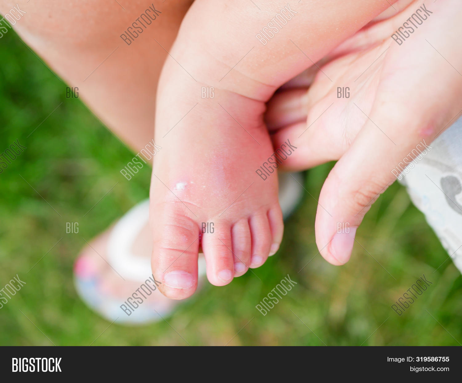 Treat Child S Wound. Image & Photo (Free Trial) | Bigstock