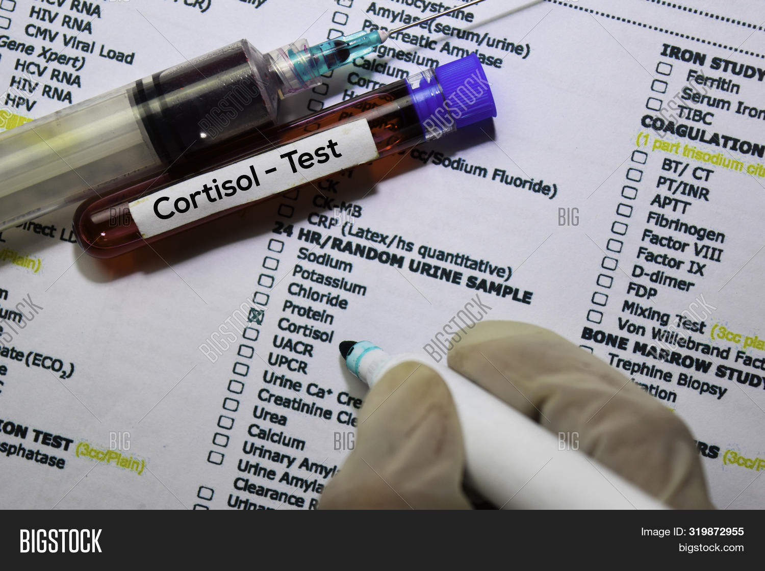 Cortisol - Test Blood Image & Photo (Free Trial) | Bigstock