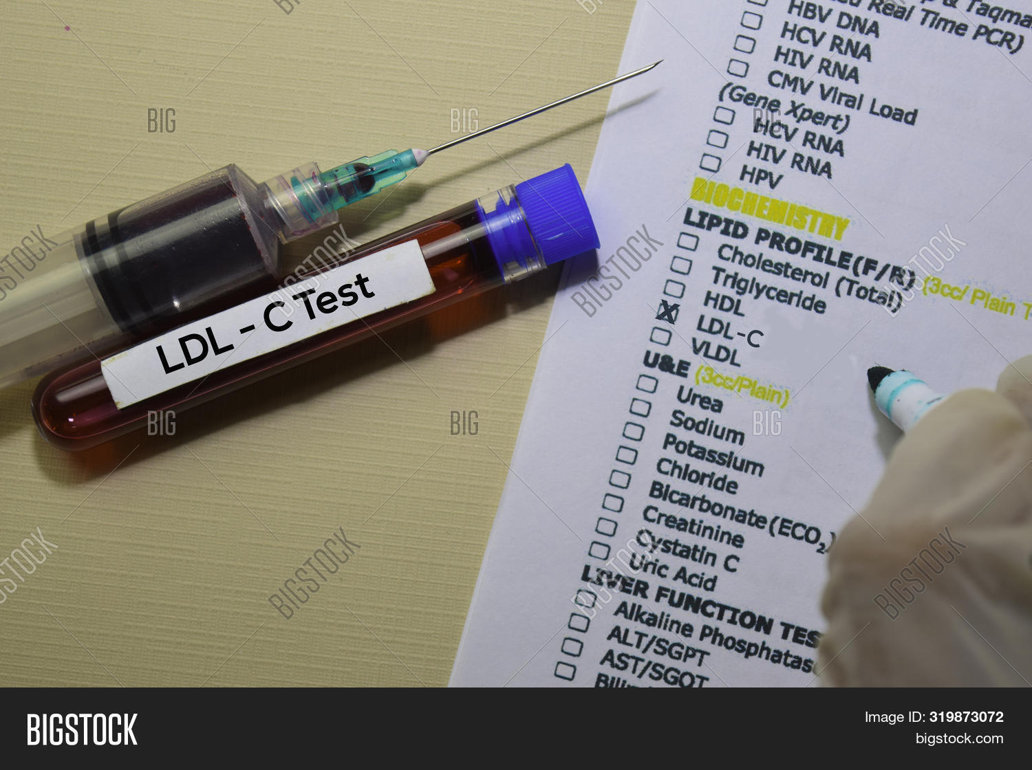 Ldl-c - Test Blood Image & Photo (Free Trial) | Bigstock