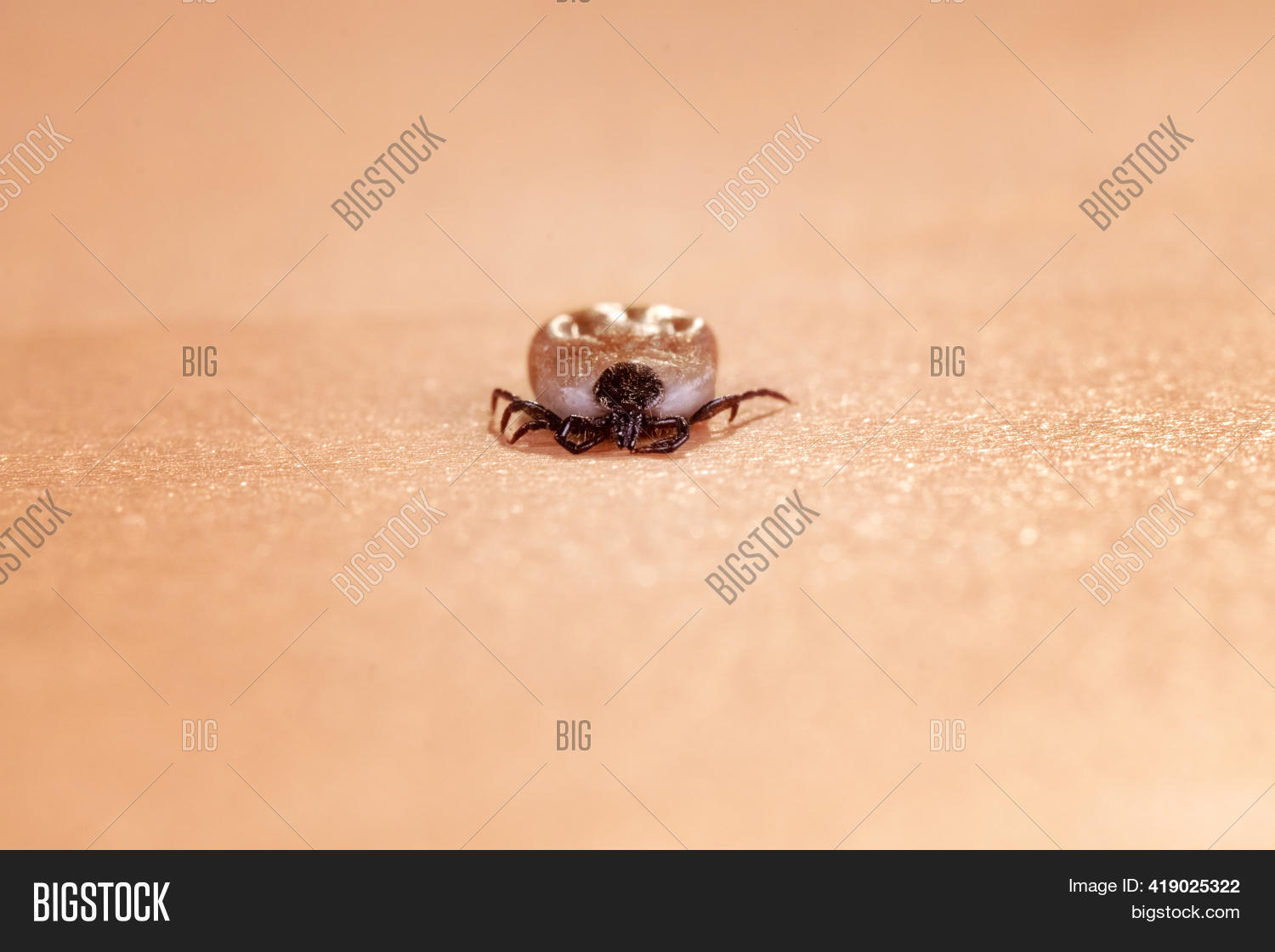 Engorged Tick On Human Image & Photo (Free Trial) | Bigstock