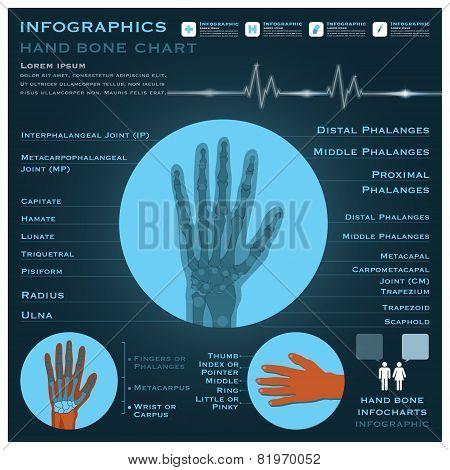 Hand Bone Infographic Vector & Photo (Free Trial) | Bigstock