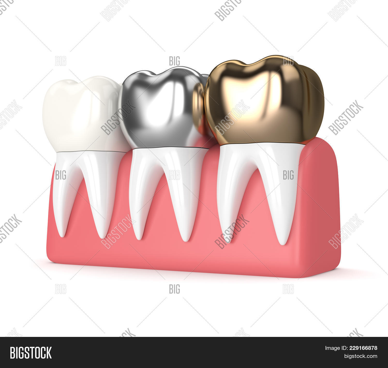 3D Render Teeth Image & Photo (Free Trial) | Bigstock