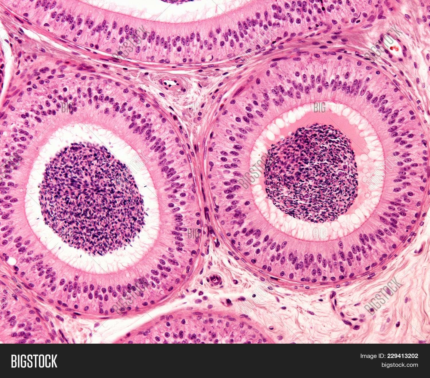 Epididymis. Image & Photo (Free Trial) | Bigstock