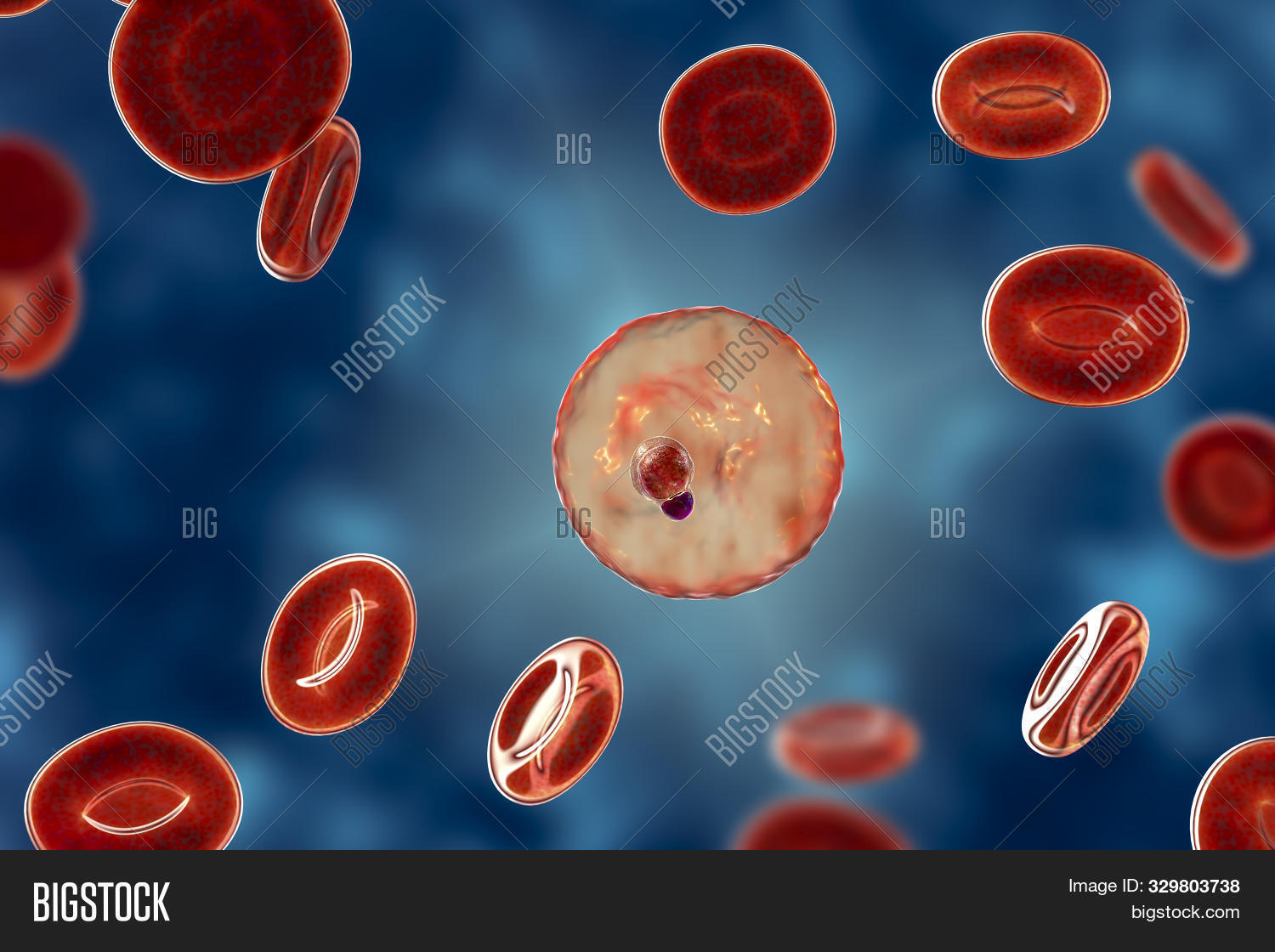 Malaria-infected Red Image & Photo (Free Trial) | Bigstock
