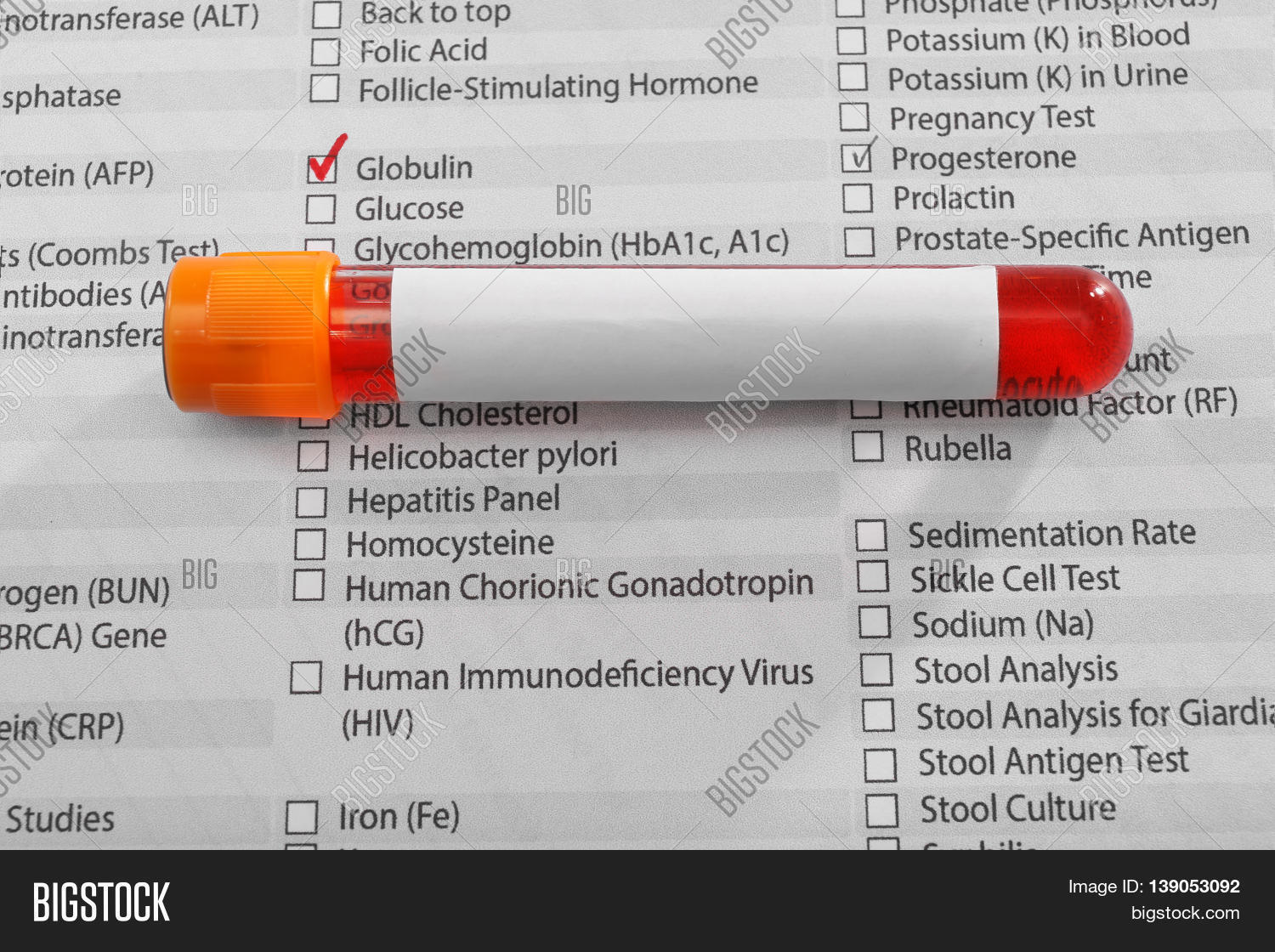 Blood Sample On Image & Photo (Free Trial) | Bigstock